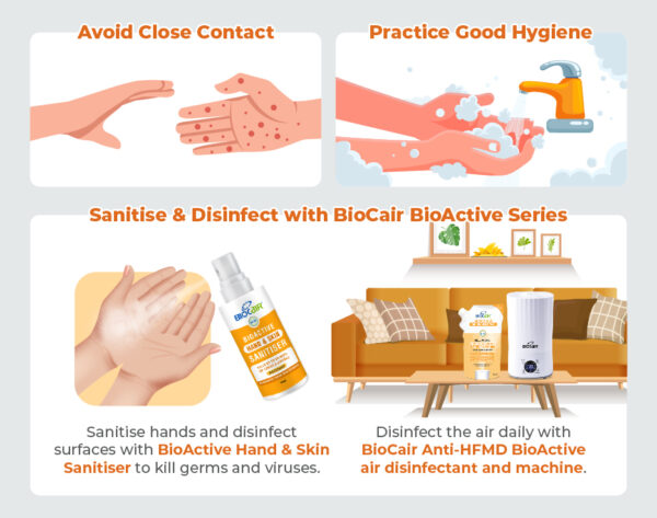 Prevent HFMD Spread at Home: What to Do If Your Child Has It